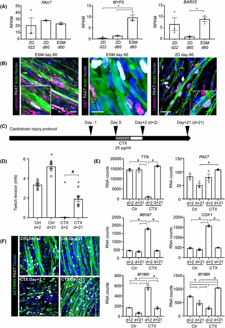 #apaperaday: Engineered skeletal muscle recapitulates human muscle ...