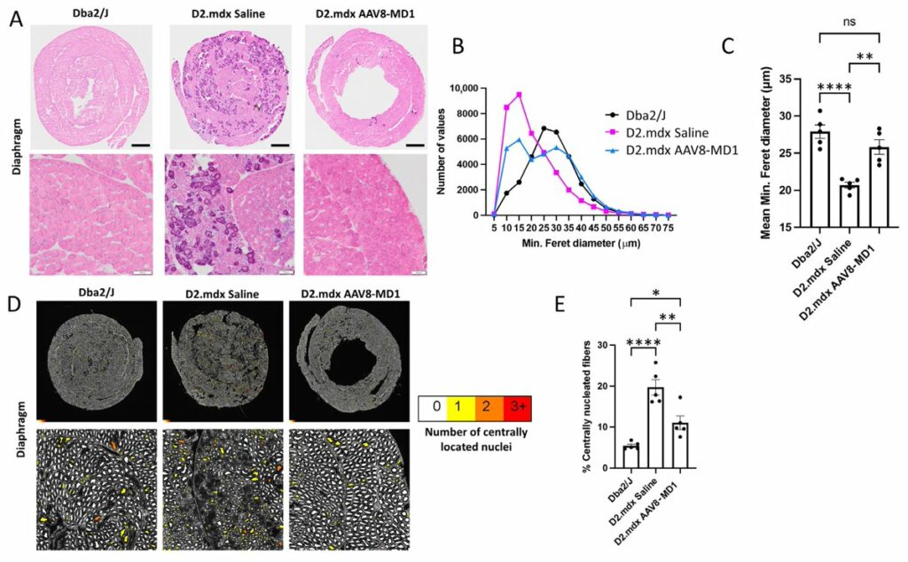 #apaperaday: Microdystrophin Gene Addition Significantly Improves ...